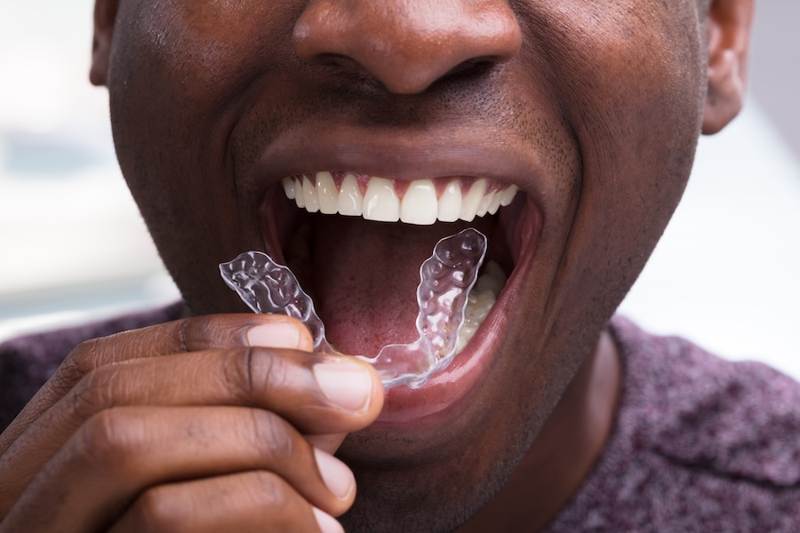How Invisalign Can Improve Your Oral Health | Seaport Family Dentistry